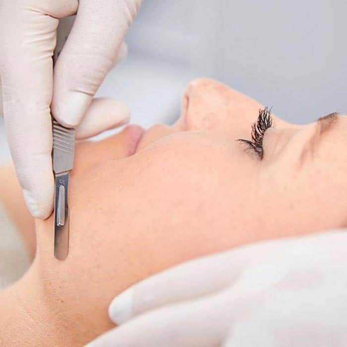 Dermaplaning Treatment – Face Food Natural Beauty Market